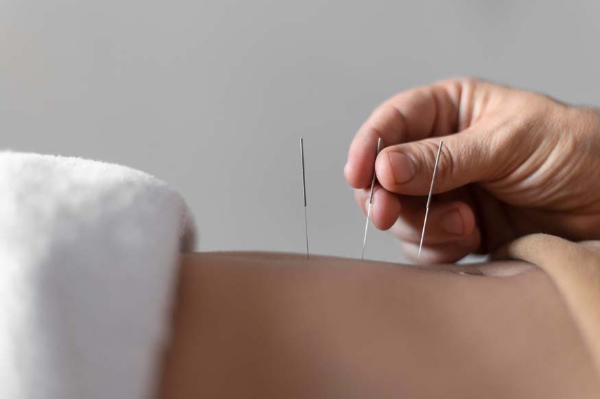 Acupuncture for Babies: Considerations and Potential Benefits