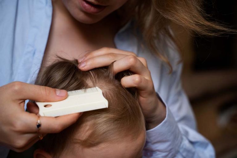 Baby Scalp Care: Symptoms, Causes, and Solutions