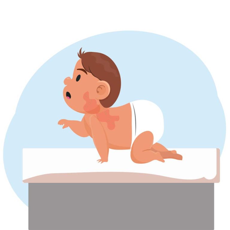 Sun Protection for Babies: A Parent's Guide