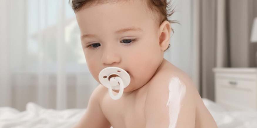 White Patches on Baby Skin: Causes & Care | EuroKids